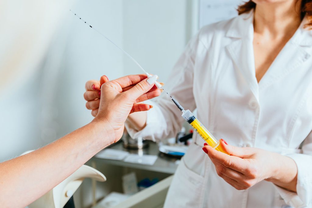 IUI - INTRAUTERINE INSEMINATION | SILLIPSIS - Yannis Koutoulakis ...